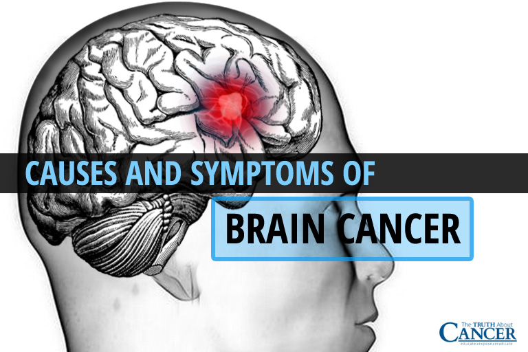 Brain tumors: Symptoms, Signs, Types, Causes, Treatments, and Survival ...