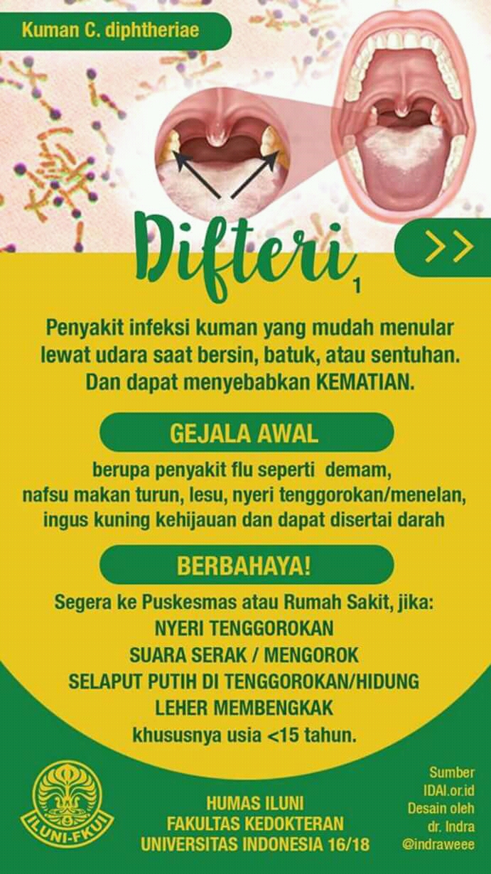 Mengenal Difteri Zaman Now ~ Raja Jempol Blog