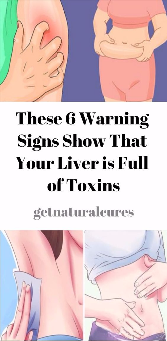 These 6 Warning Signs Show That Your Liver Is Full Of Toxins Healthylife