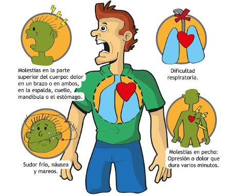 ¿Como reconocer un ataque al corazón?
