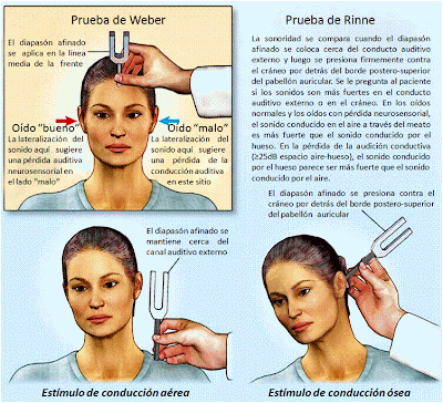 Tutomedic: Prueba de Weber, Rinne y Schwabach