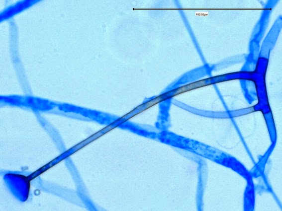Fun With Microbiology (What's Buggin' You?): Apophysomyces elegans ...