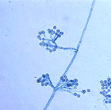 Microbiología y Epidemiología: Trichophyton rubrum. Trichophyton ...