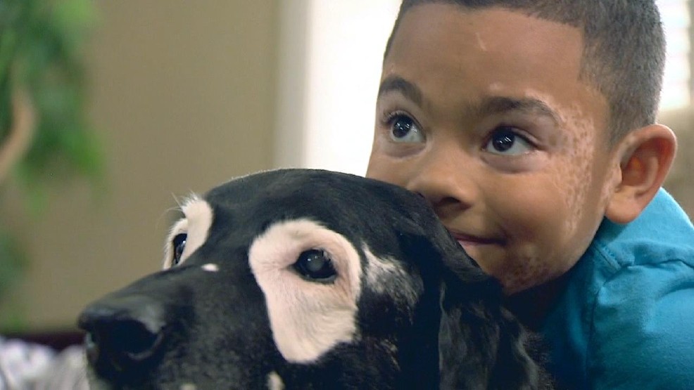 White Wolf : Boy with a rare skin disorder hates his looks, until he ...