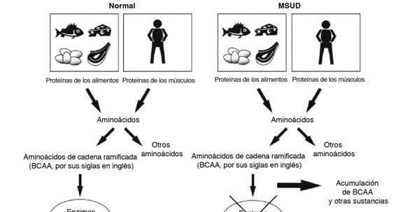 Enfermedades raras: MSUD