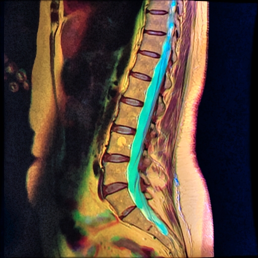 Nevit's blog: Color MRI of the Lumbar vertebrae