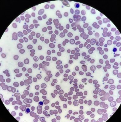 A Dull Day At Work...?: 12 April 2017 (Wednesday) - Hb C