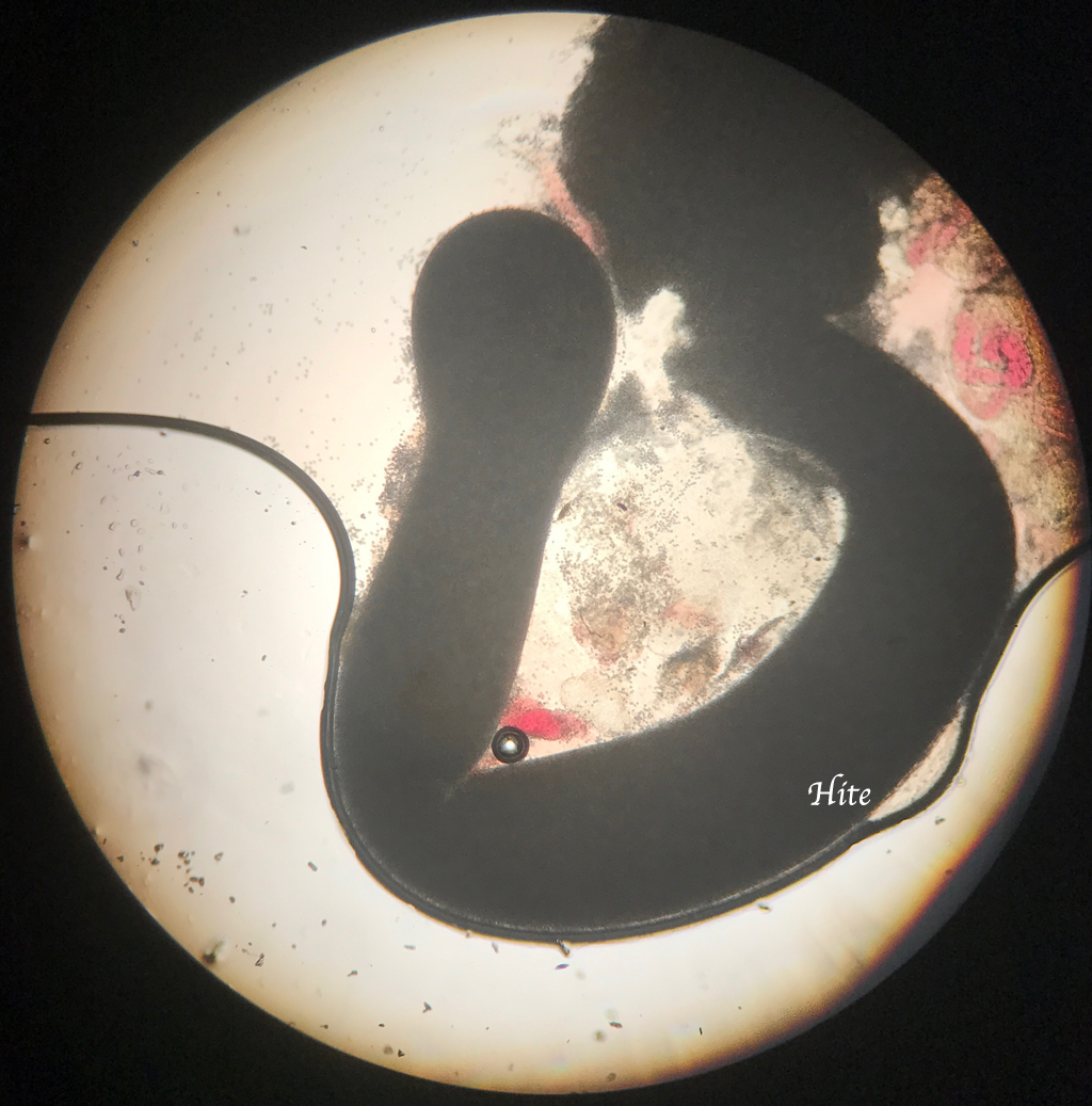 Hite's fish world: Dermocystidium