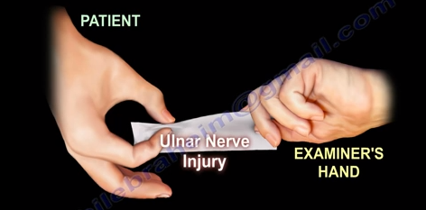 Dr. Nabil Ebraheim's Blogspot: Froment's Sign