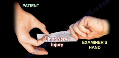 Dr. Nabil Ebraheim's Blogspot: Froment's Sign