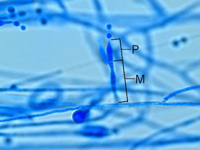 Fun With Microbiology (What's Buggin' You?): Penicillium citrinum