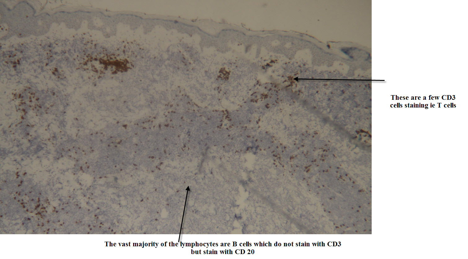 Dermatopathology Made Simple - Inflammatory: Skin Stains