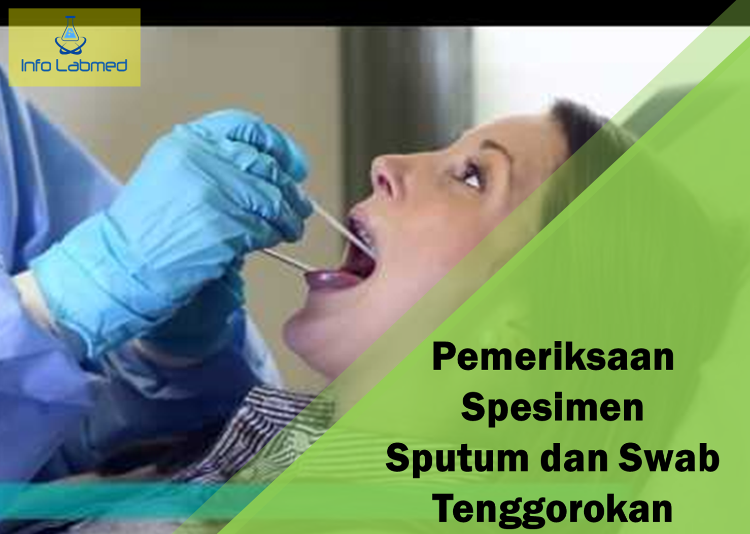 Pemeriksaan Spesimen Sputum dan Swab Tenggorokan | Menurut W.H.O