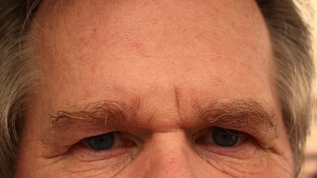 Tips To Get Rid Of Forehead Wrinkles At 20 tips-to-get-rid-of-forehead-wrinkles-at-20
