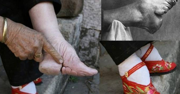 Kaki Lotus, Tradisi Aneh Wanita di China - DringkingVora