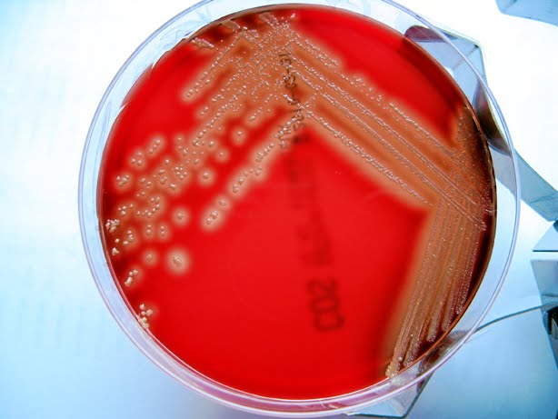 herenciageneticayenfermedad: La infección por 'Dermatophilus ...