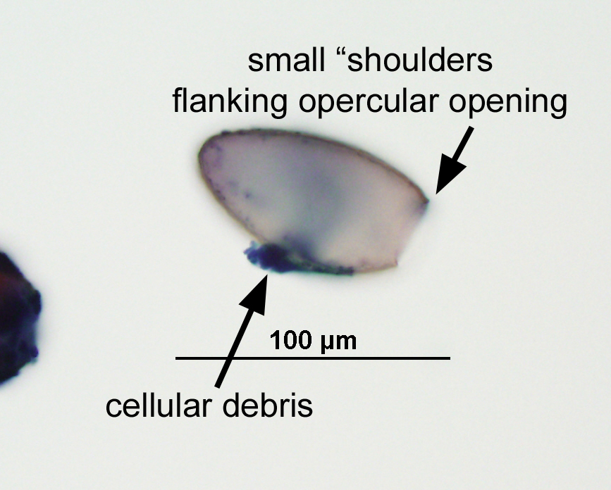 Paragonimus Westermani Egg Operculum