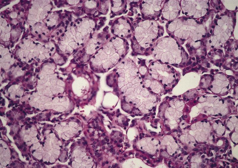 Histología en Imágenes : GLANDULA SEROSA O MUCOSA??