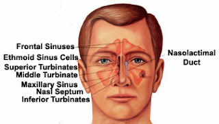 Faktor Penyebab Penyakit Sinusitis | Obat Tradisional dan Ramuan Herbal