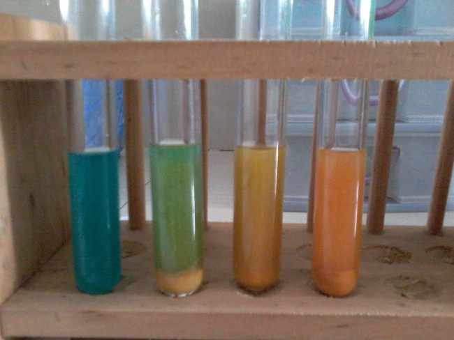 SFN NETWORKS: PEMERIKSAAN GLUKOSA URIN METODE BENEDICT