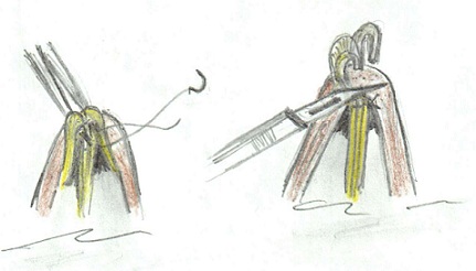 MCQ's in Facial Plastic & Reconstructive Surgery: 1211-1220 MCQ in ...