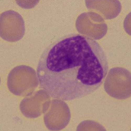 Hematología Fichas: Monocito
