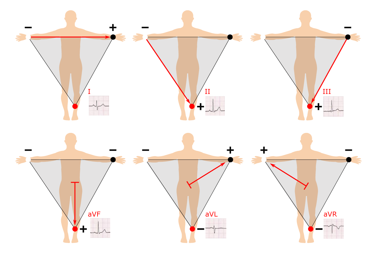 The 12 Lead ECG The 12 Lead ECG