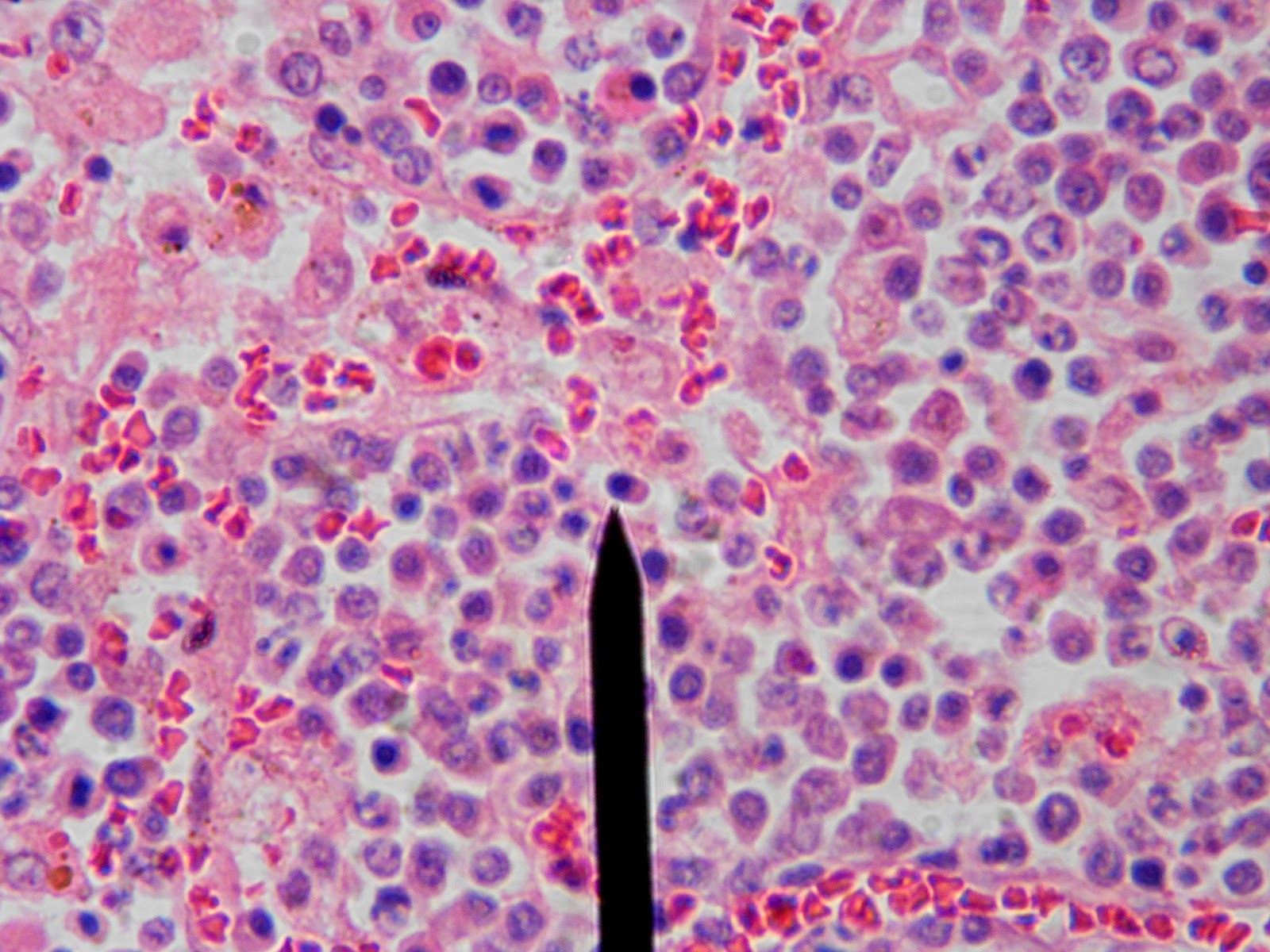 Placas Histologicas : Plasmocitos