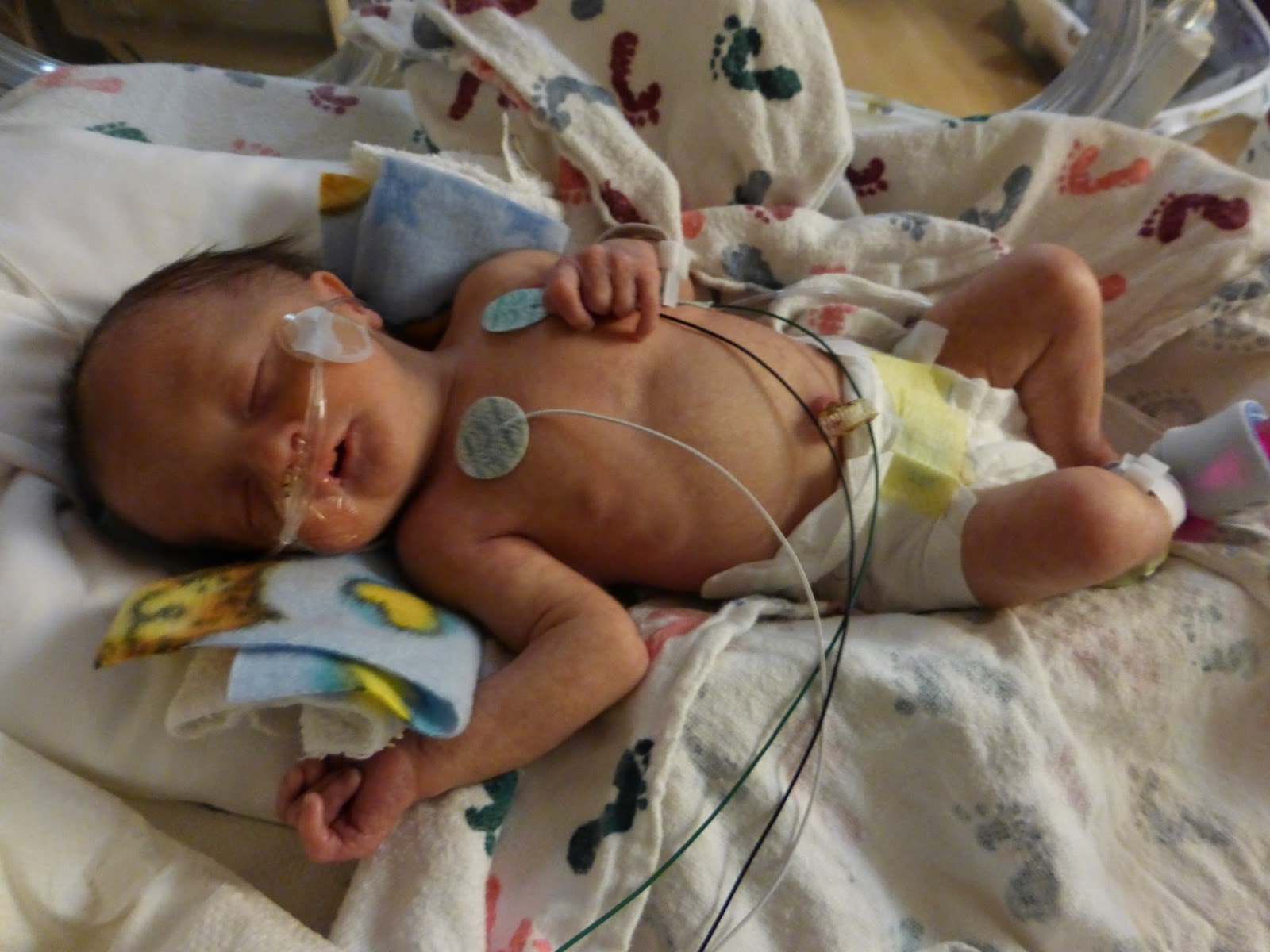 Cherishing Elise: Carrying and Loving Our Trisomy 18 Baby: Elise ...