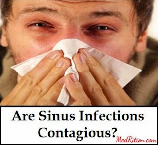 Are Sinus Infections Contagious – MedRition