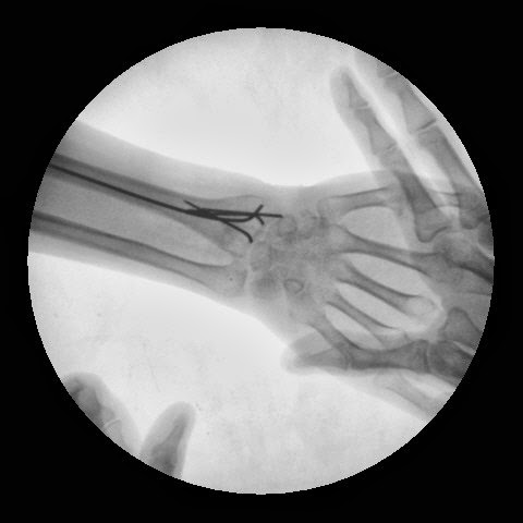 MY LOVE2009: KIM KIRSCHNER GÃY TRONG LÒNG TỦY