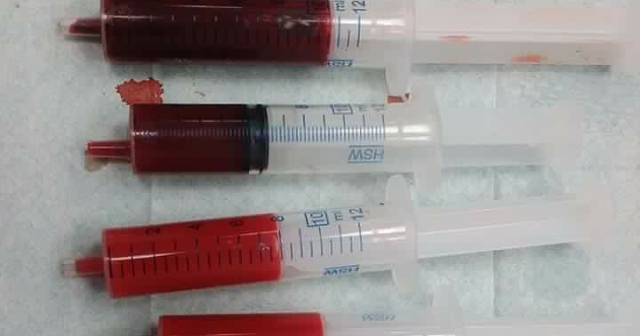 Biologia é Vida!: Sangue arterial X sangue venoso