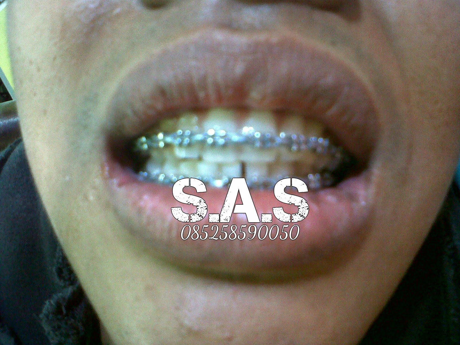 S.A.S - AHLI GIGI KOTA PATI, Jateng & KOTA JEMBER, Jatim: Tahap ...