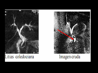 COLANGIO RM: COLANGIO RM