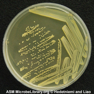Wonalixia© Bittersweet: ESTAFILOCOCO DORADO (STAPHYLOCOCCUS AUREUS ...