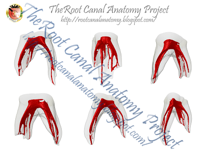 The Root Canal Anatomy Project: Primary molars are easy!