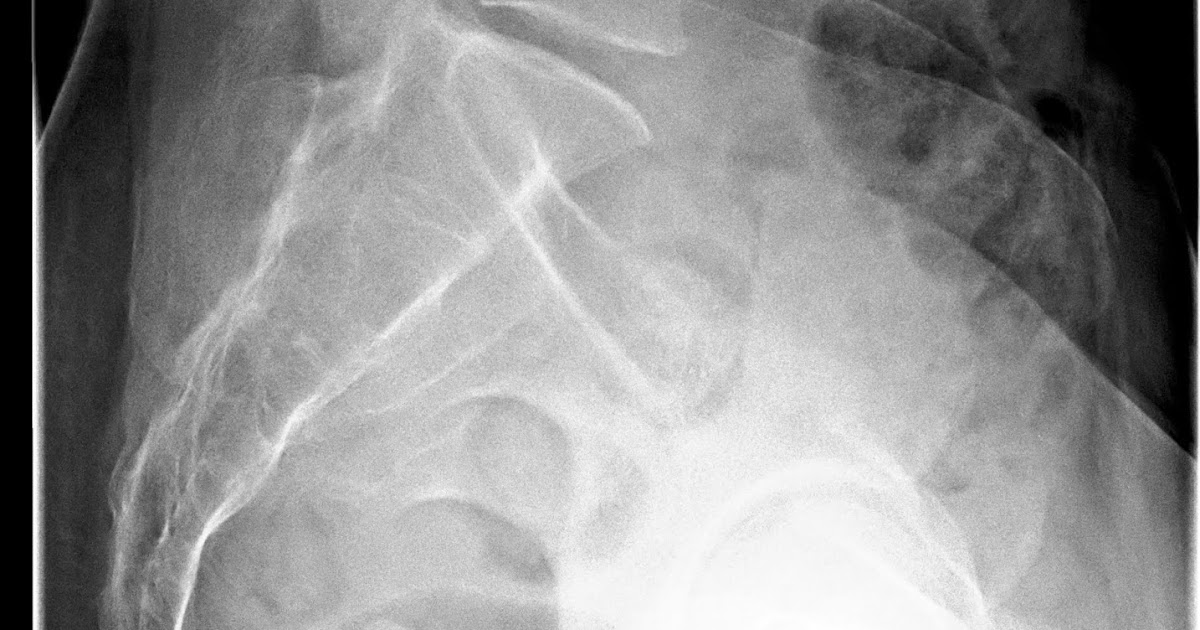 Raio X Sacro Coccix - RETOEDU