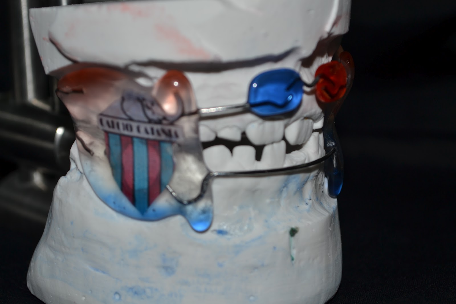 Laboratorio Ortodontico MRdental: FRANKEL 3