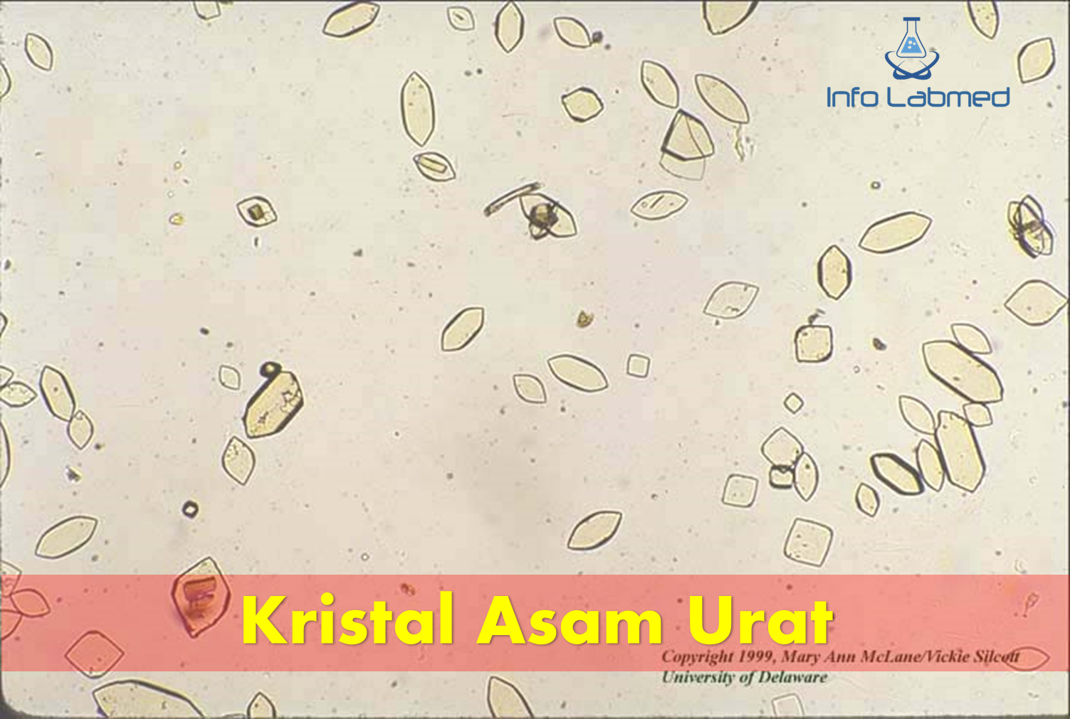 Kristal Sedimen Urin yang Sering Ditemukan - seri Edukasi Teknologi ...