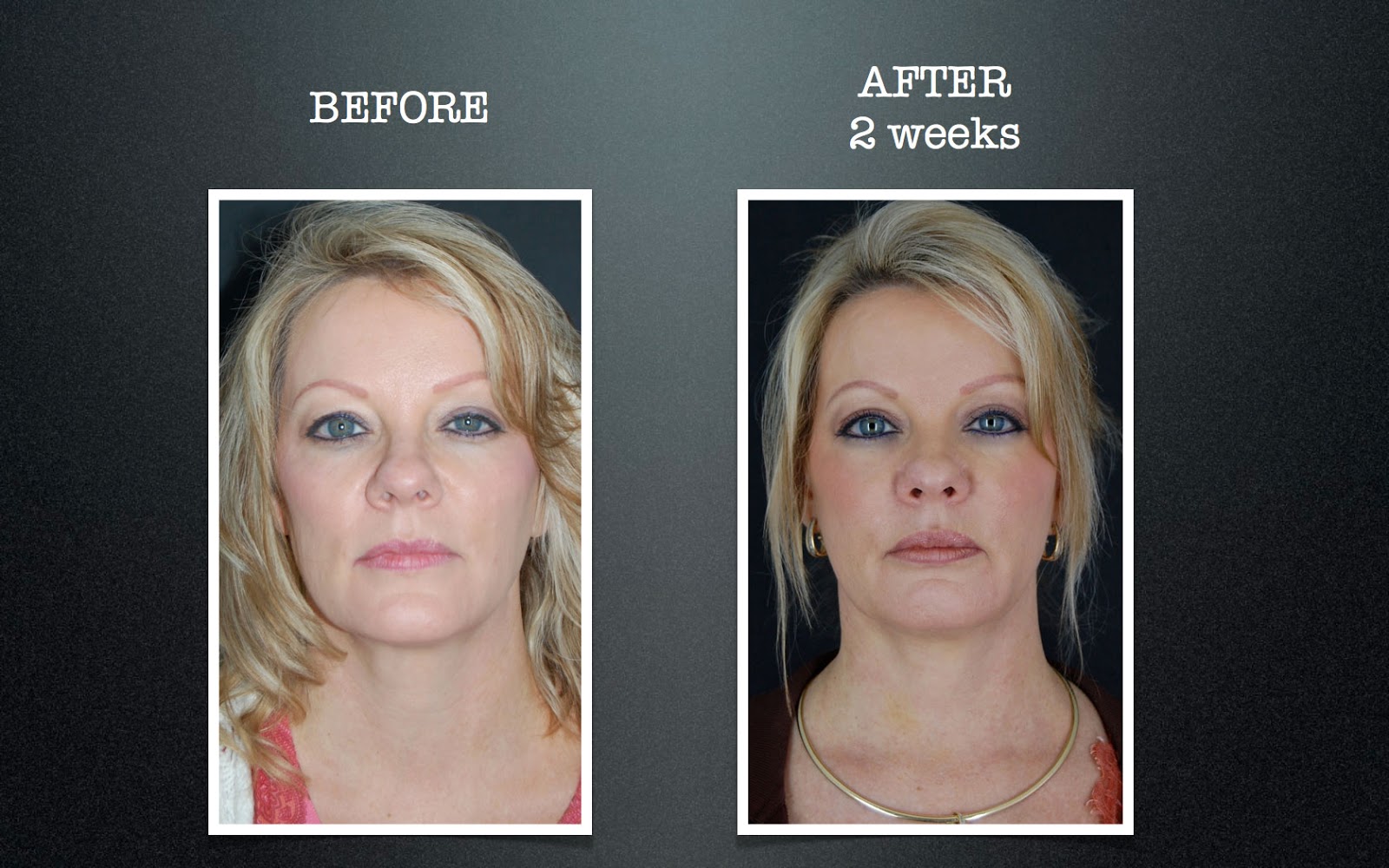 Jacksonville Plastic Surgery and Cosmetic Surgery | Breast Augmentation ...