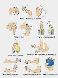 TOGWT: Hand Exercises to alleviate Repetitive Strain Injury (RSI)