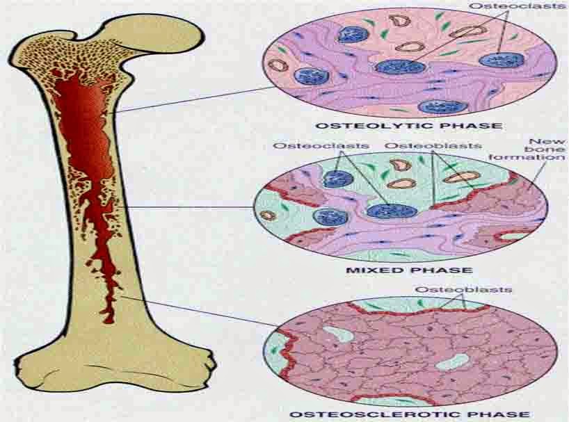 Metabolic Bone Disease ~ Healthy Subjects