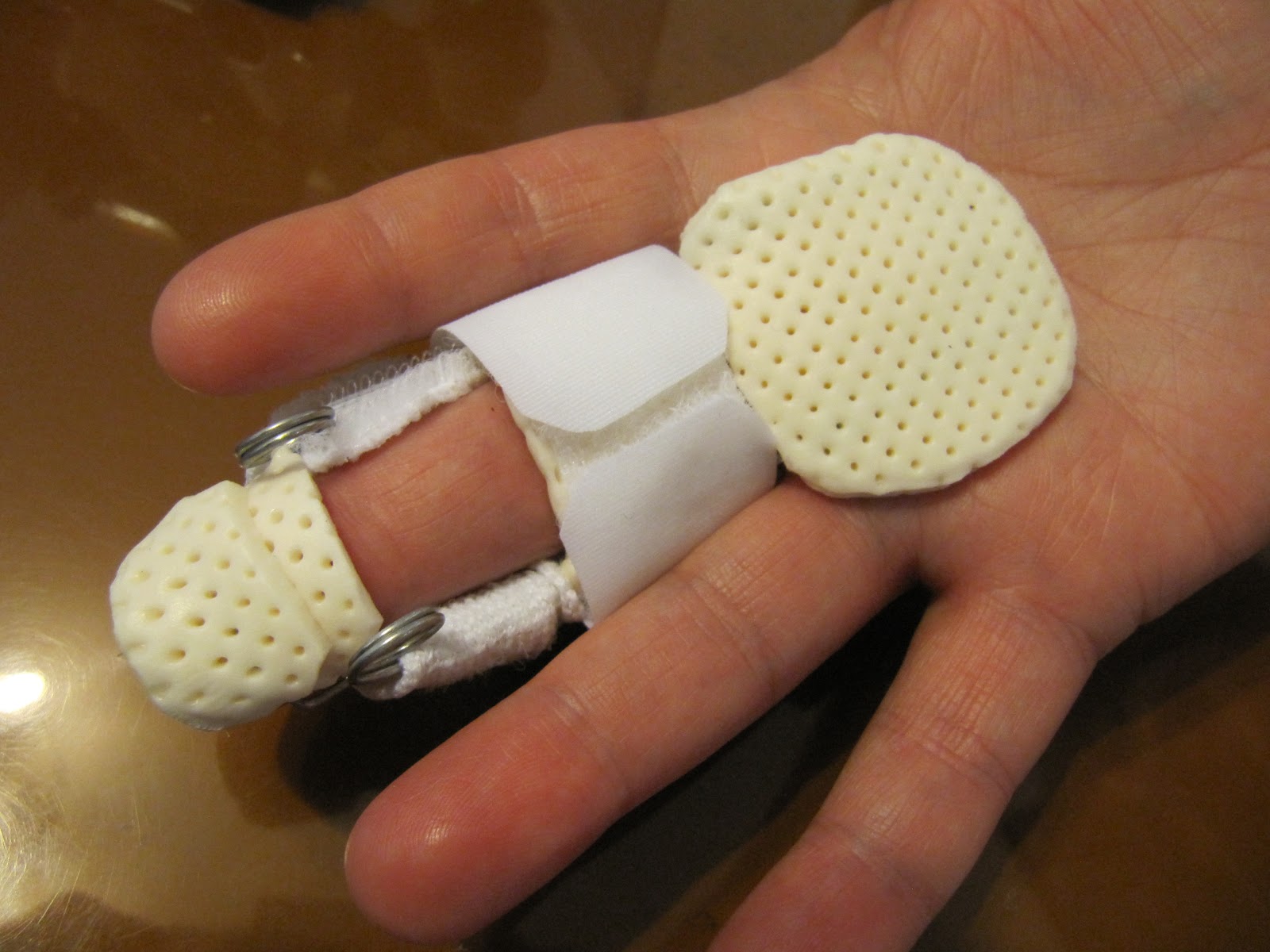 Orthèses Main-Poignet Lyon : photos