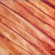 Sistemul Muscular: Sistem Muscular