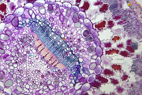 Microscope World Blog: Pine Tree under the Microscope
