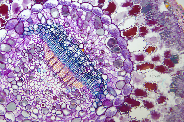Microscope World Blog: Pine Tree under the Microscope