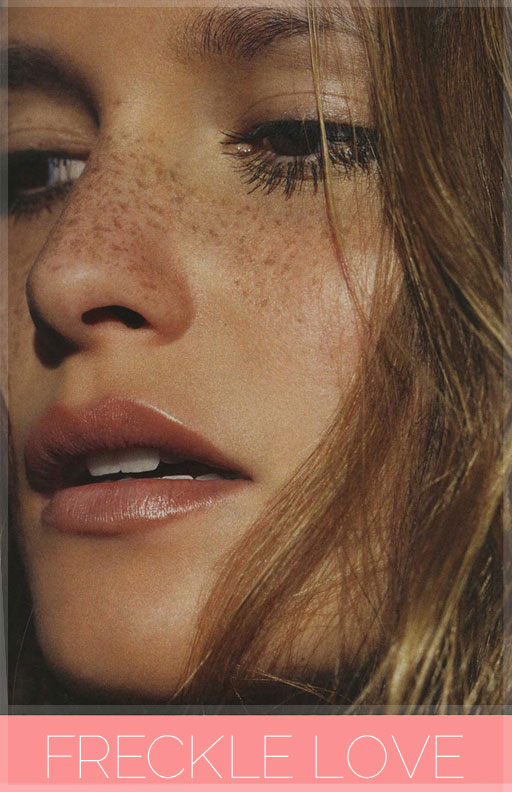 A Beautiful Mess: Freckle Love