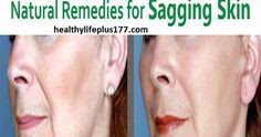 5 Effective home remedies for sagging skin
