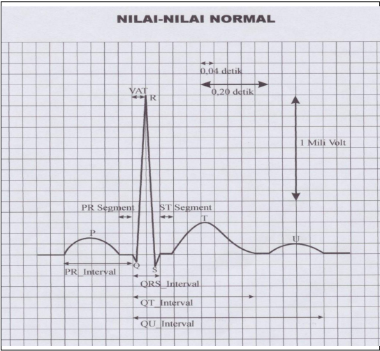EKG dan Ilmu Dasarnya