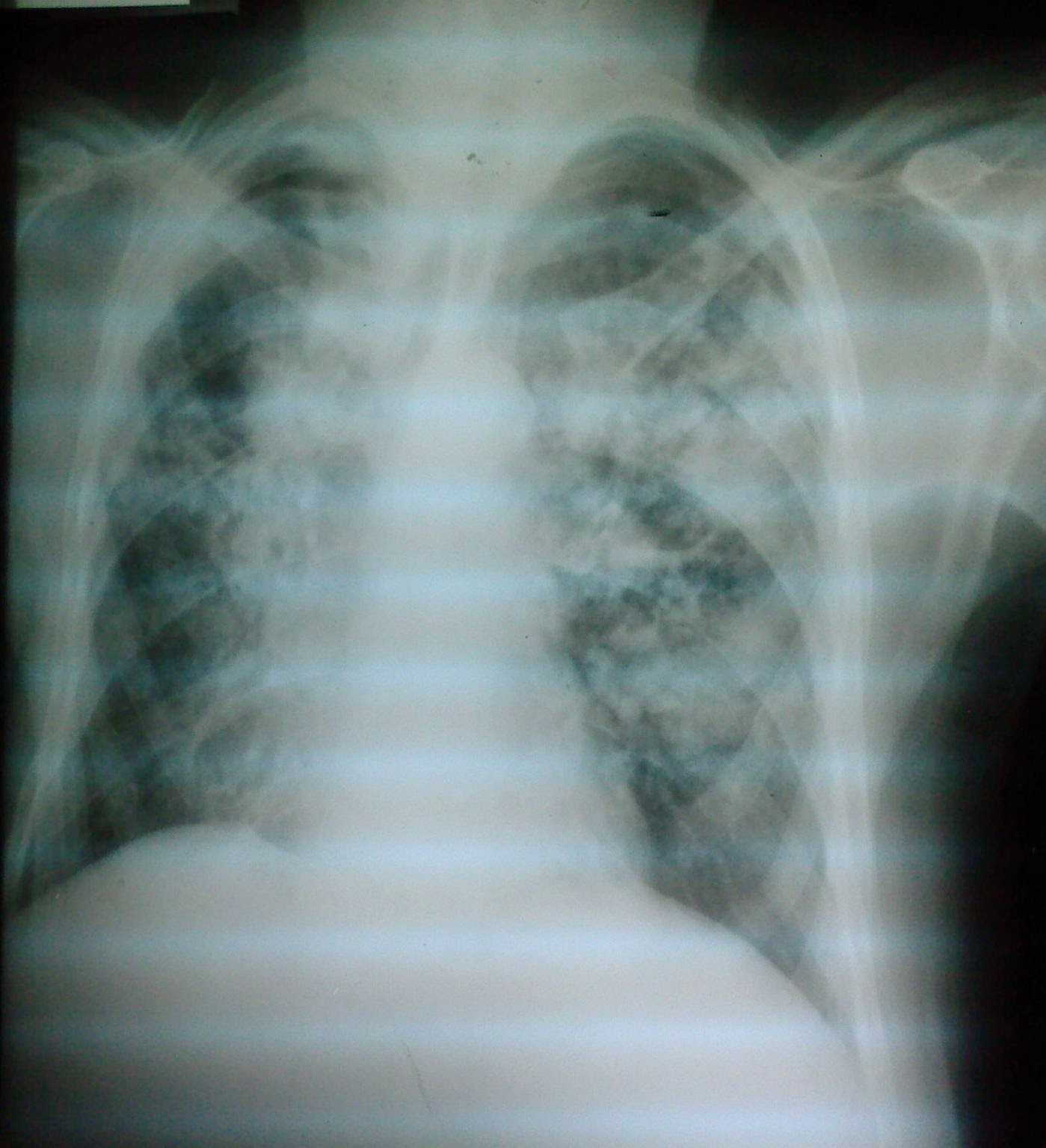 Telethorax